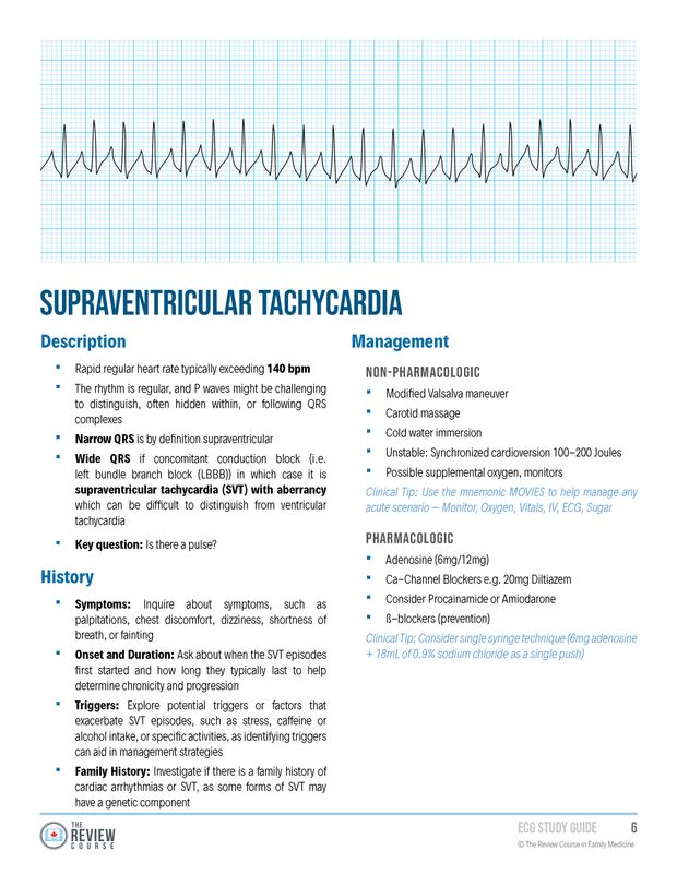 Ekg Study Guide