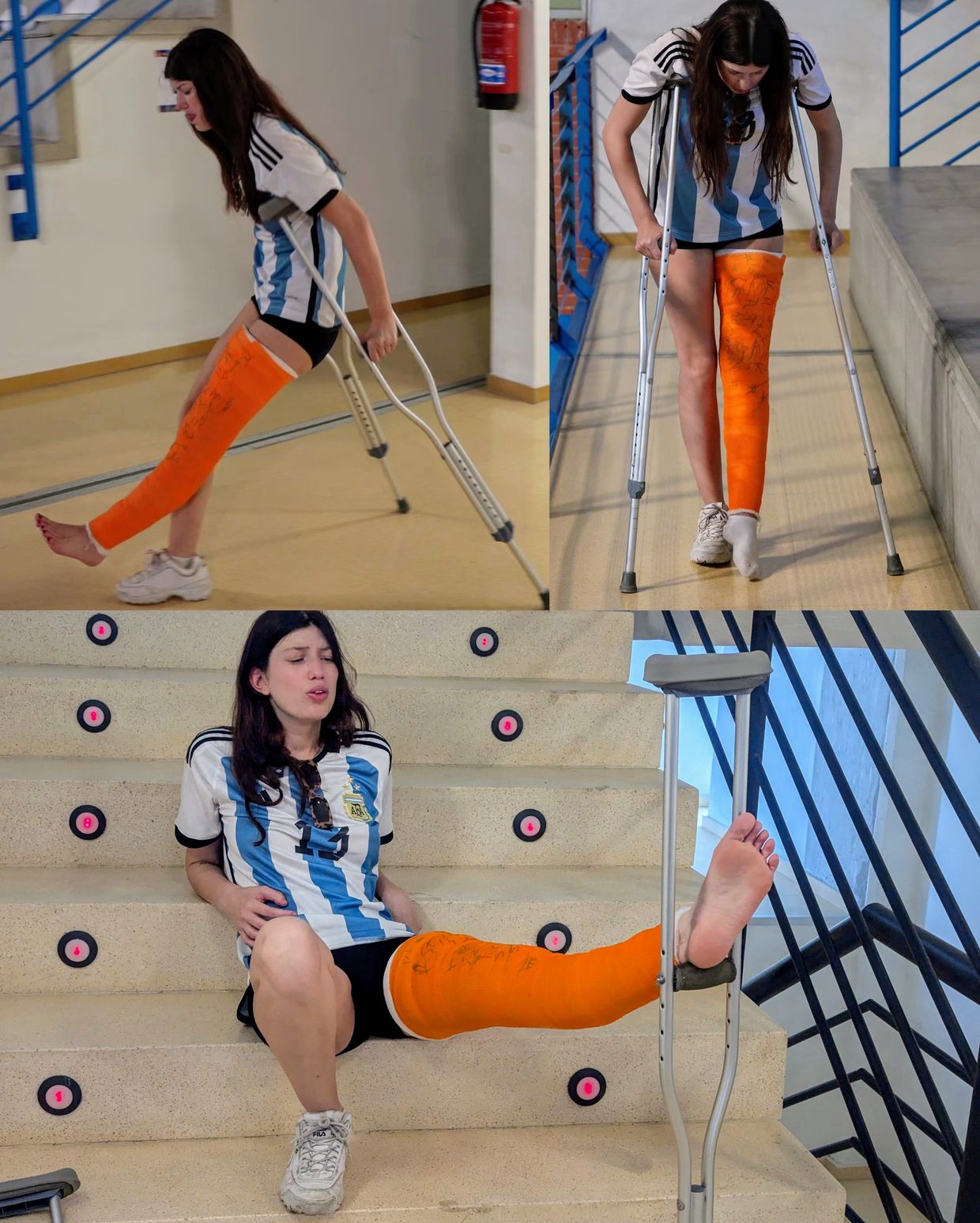 Soccer player CLC · high pain · crutching · sock on-off by Carlota