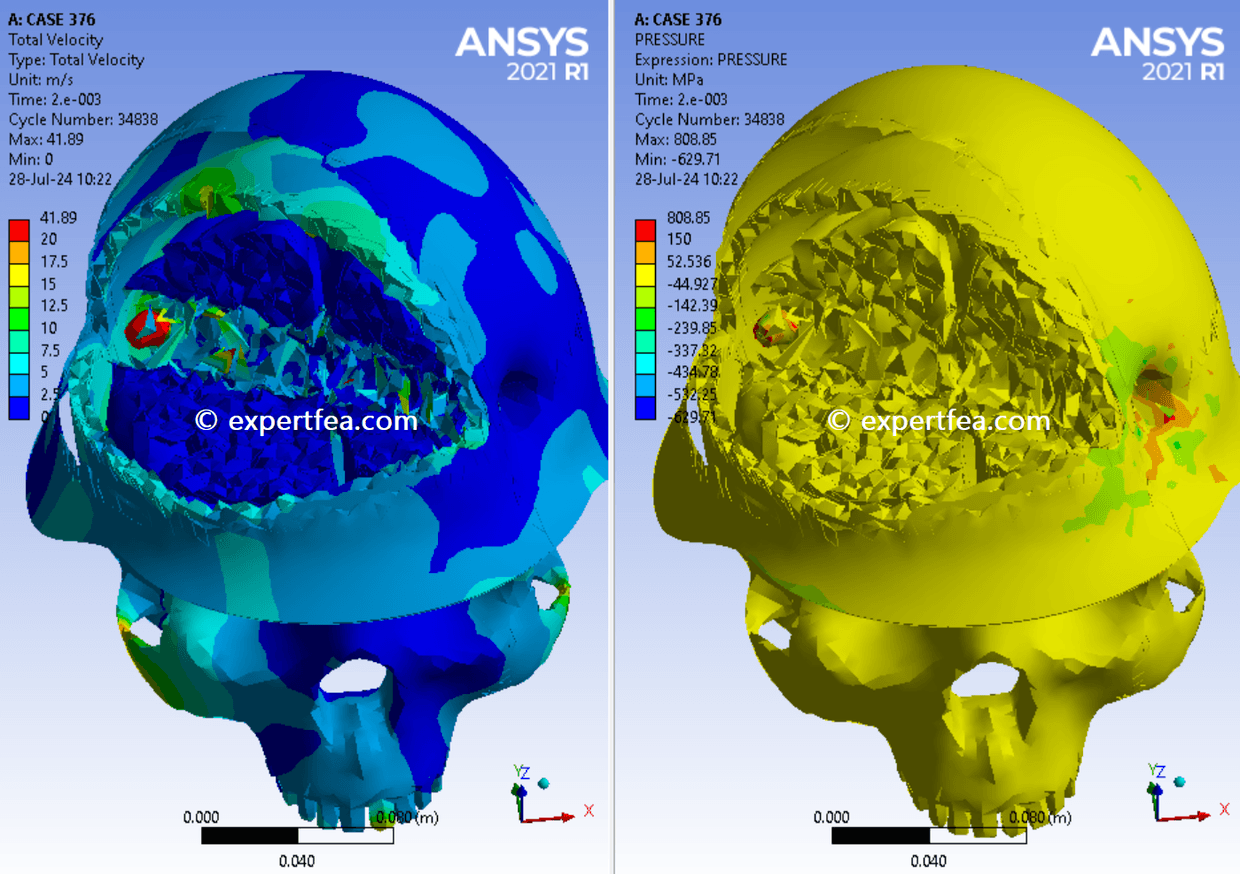ANSYS Workbench 2021 R1 WBPZ archive + 3D file for Short Distance ...
