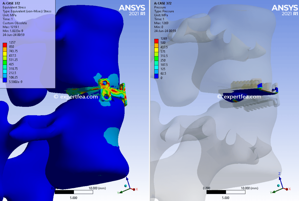 ANSYS Workbench 2021 R1 WBPZ archive + 3D file for FEA of Cervical Disc ...