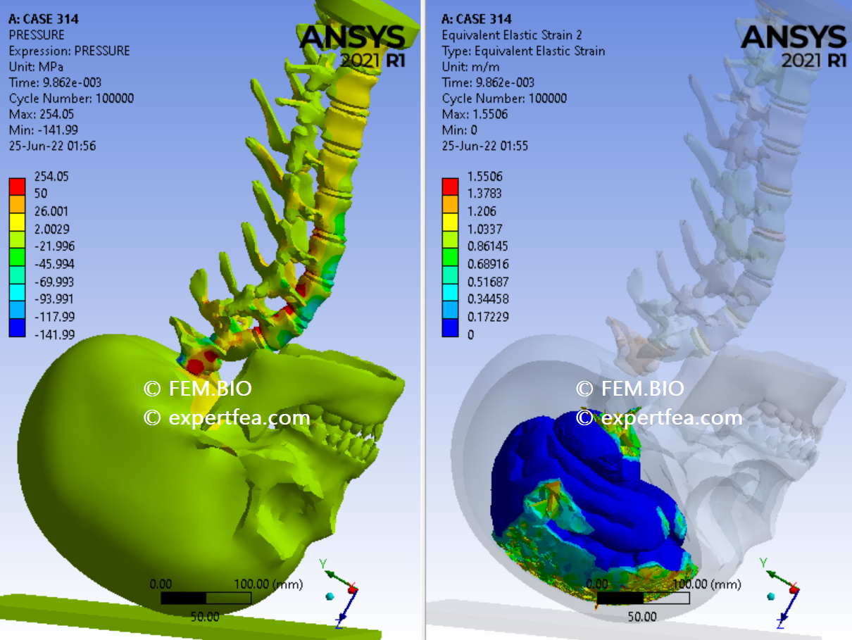 ANSYS Workbench 2021 R1 WBPZ archive + 3D model for Compression Shock ...