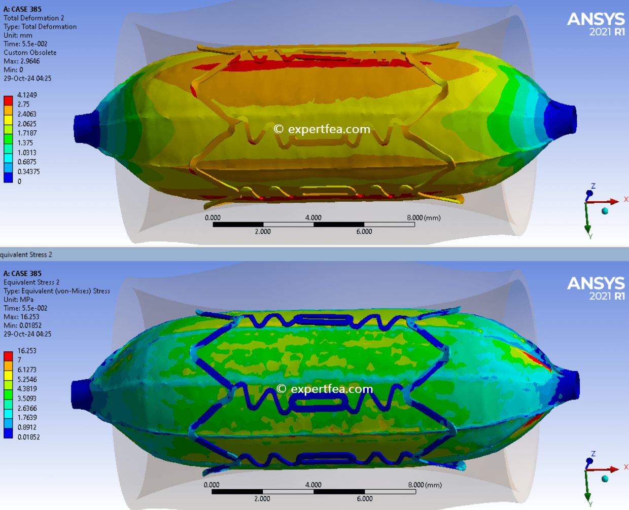 ANSYS Workbench 2021 R1 WBPZ archive + 3D model of tri-fold balloon catheter v2