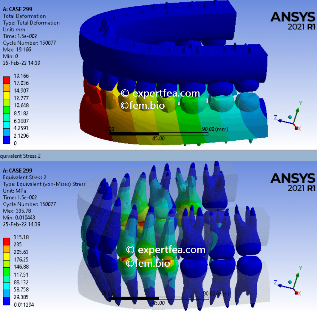 ANSYS Workbench 2021 R1 WBPZ archive with 3D model for FEA of biting ...