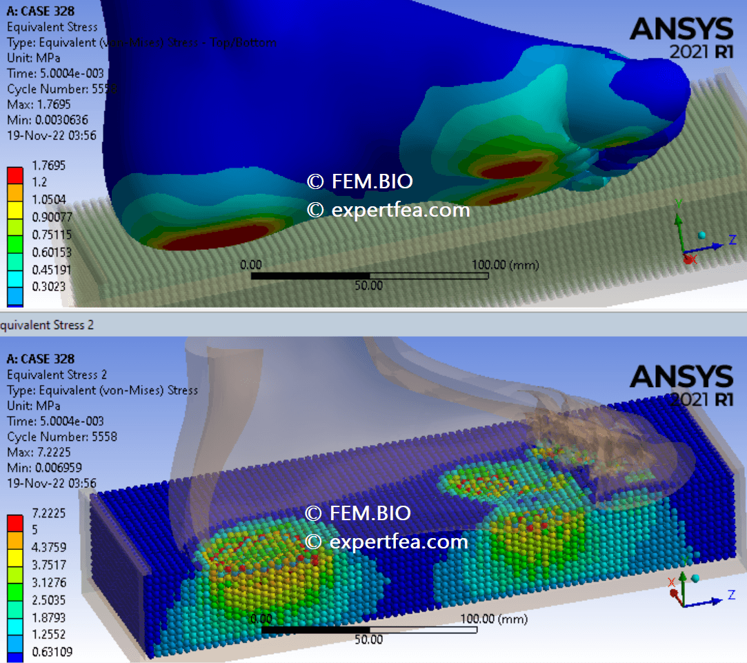 ANSYS Workbench 2021 R1 solved WBPZ archive and 3D model for plantar ...