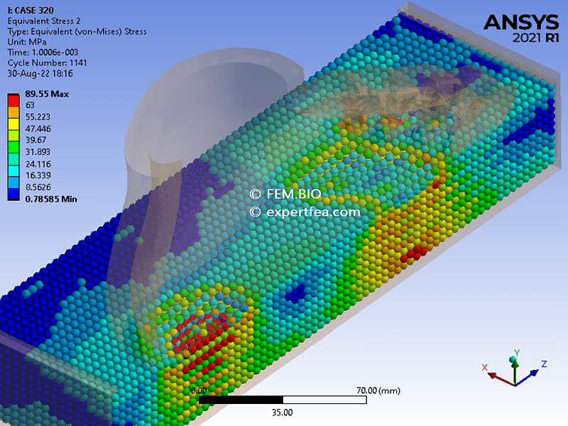 ANSYS Workbench 2021 R1 solved WBPZ archive and 3D model for Plantar Pressure on Soil (v1)