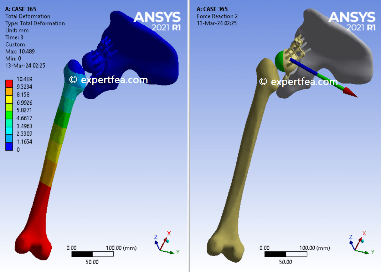 ANSYS Workbench 2021 R1 solved WBPZ archive and 3D model for FEA of ...