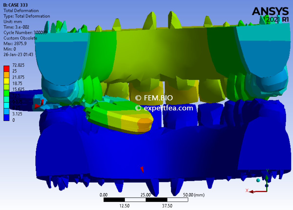 ANSYS Workbench 2021 R1 solved WBPZ archive with 3D model for ...