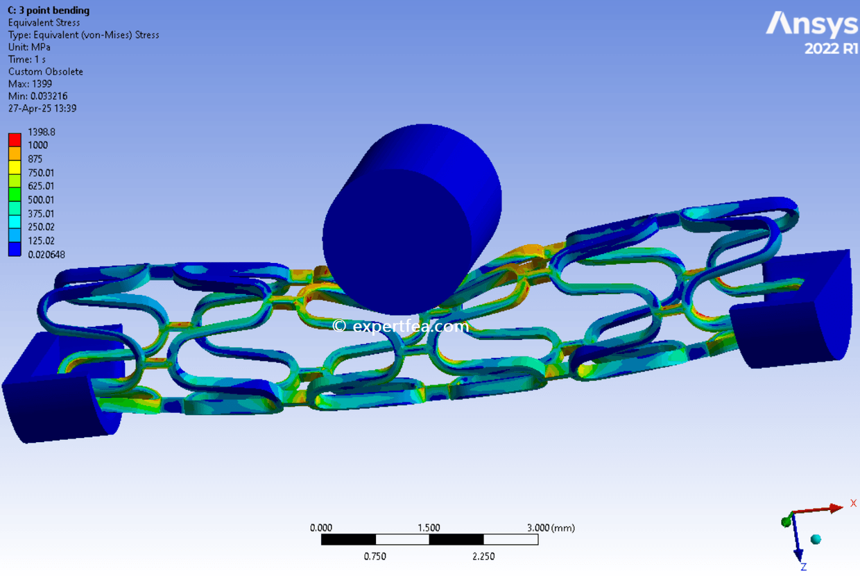 ANSYS Workbench 2022 R1 solved WBPZ archive and 3D model for Extenson, Torsion and Bending of Stent